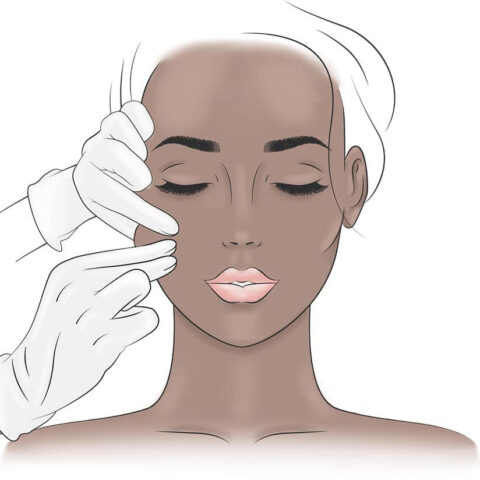 Bindweefselmassage | anti-aging | verbetering huidconditie | collageen